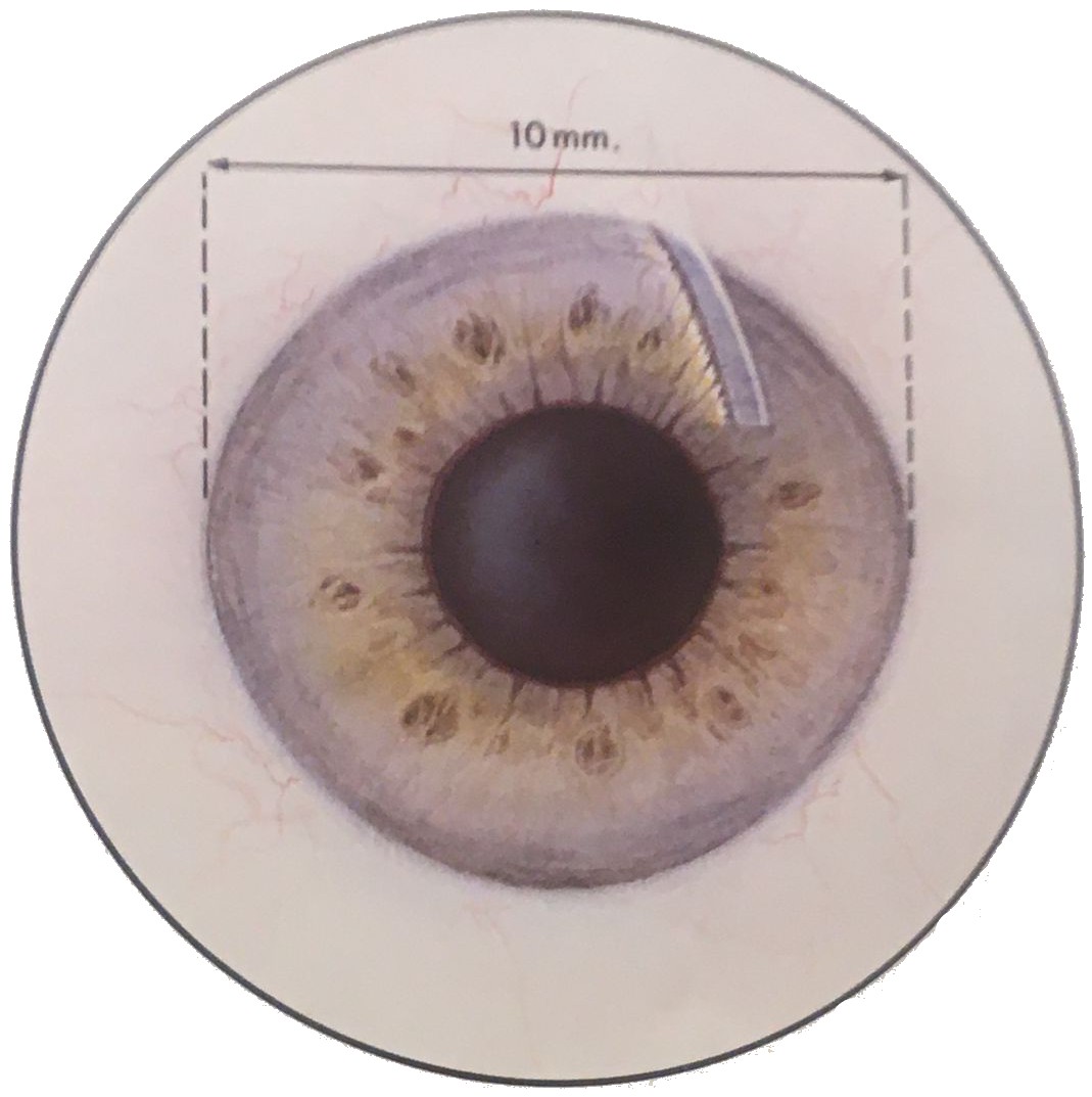 Nanophthalmos - Mr Eyes
