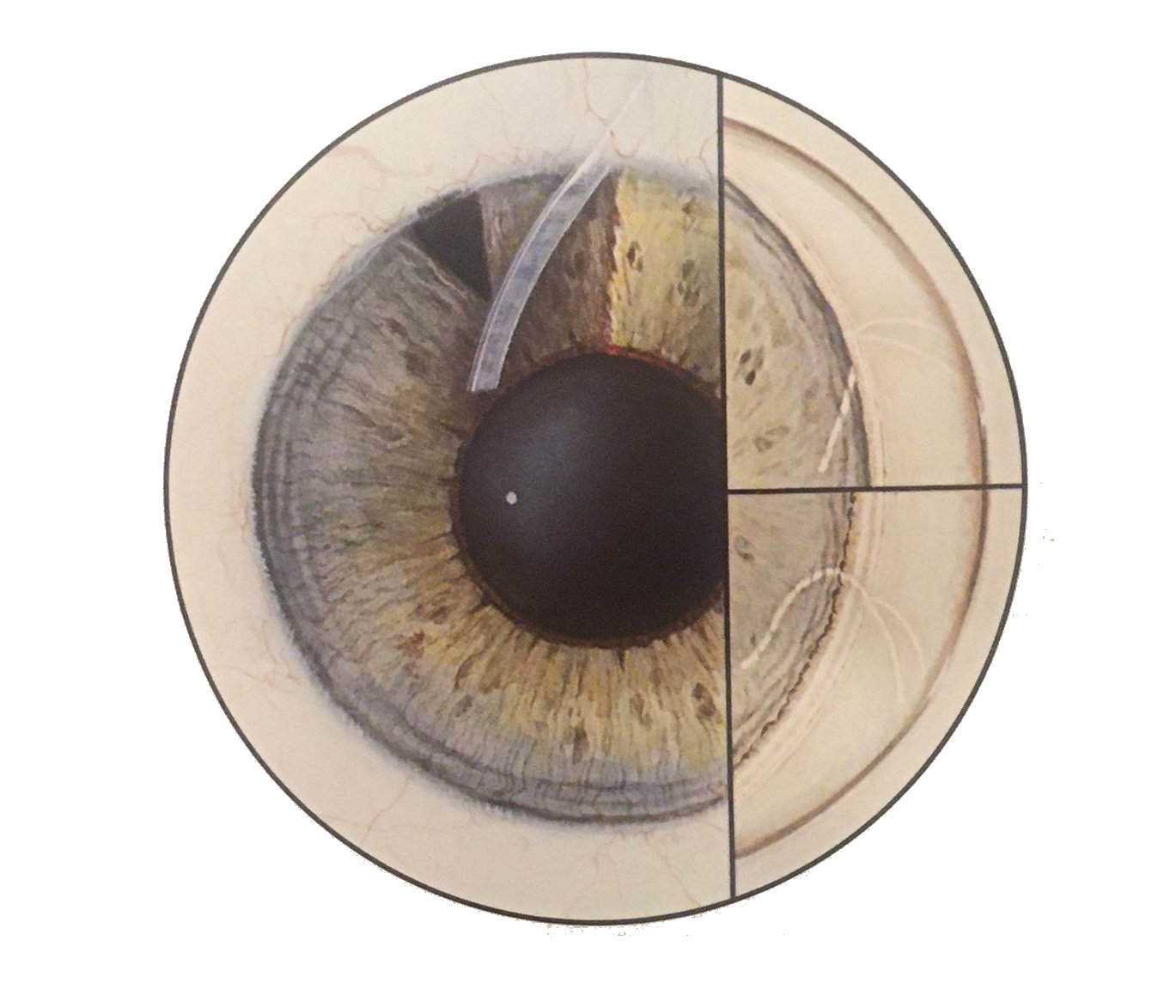 Common Eye Conditions - Mr Eyes